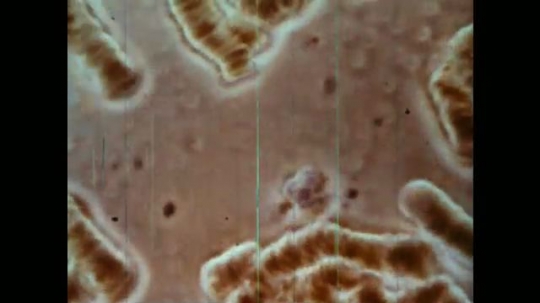 UNITED STATES 1950s: Magnified view of white blood cells. – Archival ...