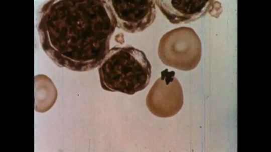 UNITED STATES 1960s: Arrow points to cell. Dark and light color cells ...