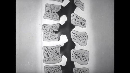 UNITED STATES: 1950s: animated section of ligaments around spine ...