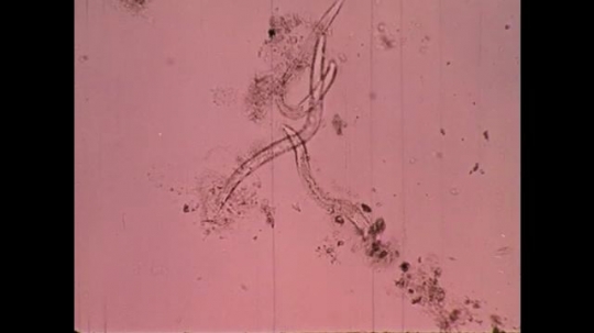 1970s: Magnified parasites wriggle and writhe. Cartoon animation of ...