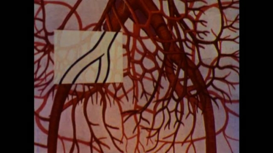 United States: 1960s: close up animation of blood vessel. Drawing of ...
