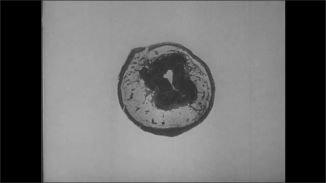 1930s: Drawing Of Human Appendix. Cross-Section Of Appendix With ...