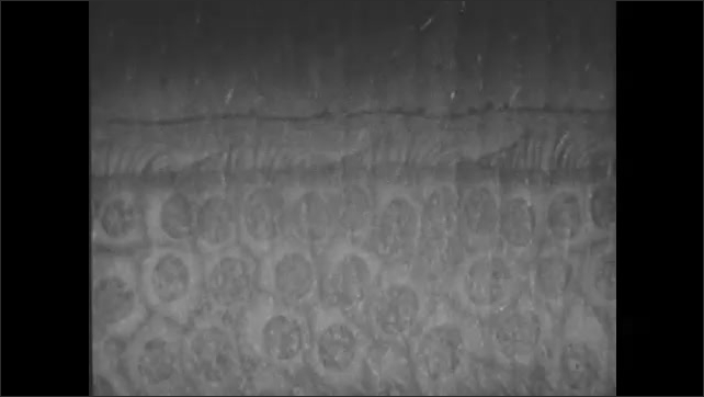 1930s: Diagram Of Skin And Cells Underneath Being Damaged By An Object ...