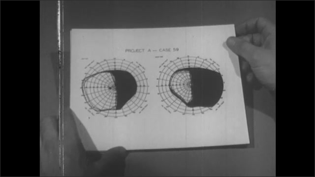 1950s: UNITED STATES: regions of blindness mapped on visual field chart ...