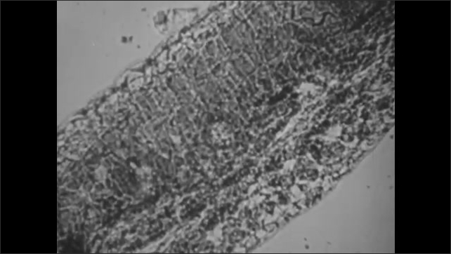 1940s: Amoeba. Different types of cells. – Archival Footage