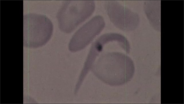 1960s: Microscopic image of normal red blood cell highlighted ...