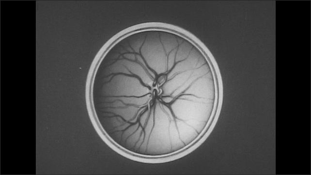 1940s: Animated diagram of a human eyeball. Veins in eyeball. Diagram ...