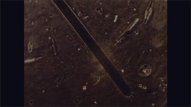 1960s: UNITED STATES: single cell algae under microscope. Algae joined ...