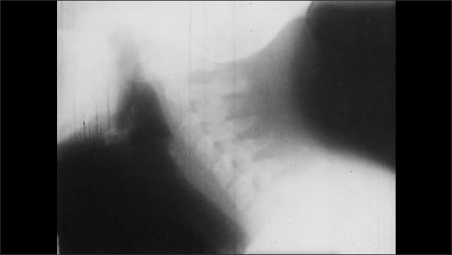1950s: Human skeleton model: jaw, neck vertebrae, shoulders. X-ray of ...
