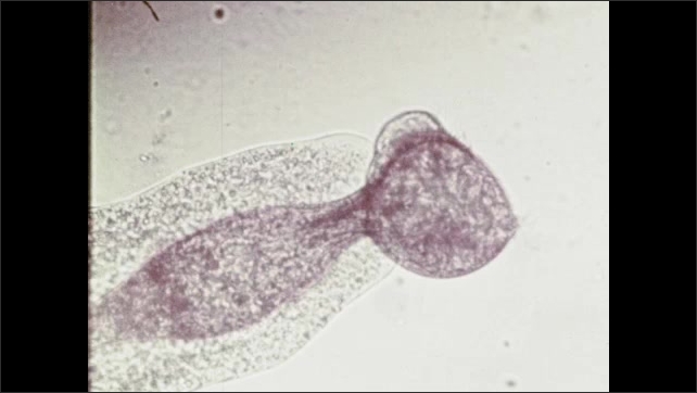 1970s: Microscopic amoeba moves. – Archival Footage