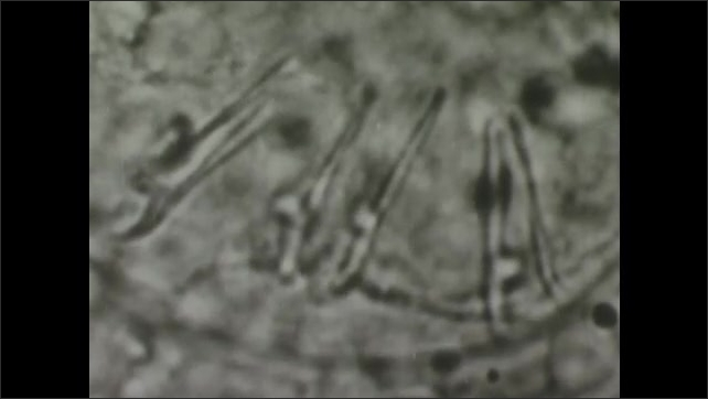 1940s: Hatched tapeworm embryo under microscope, movement of hooks is ...