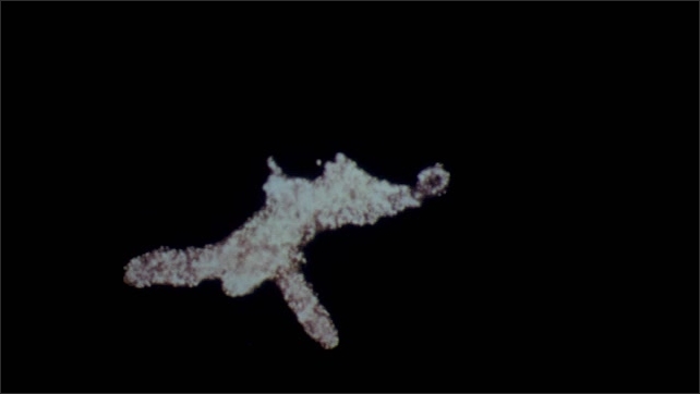 1960s: UNITED STATES: amoeba movement under microscope. Microscopic ...