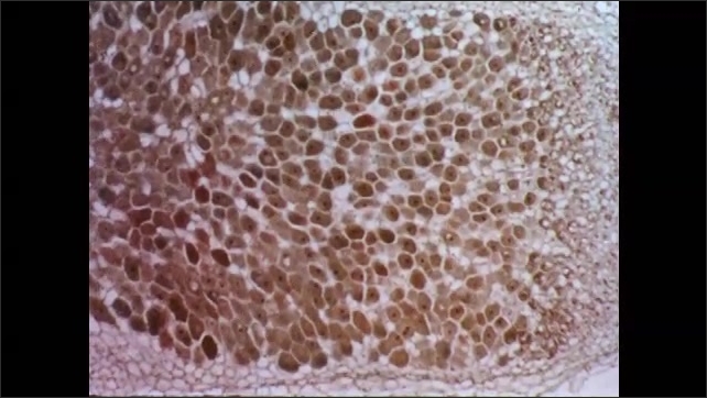 1960s: Microscopic view of bacteria nodule on plant root. Field of ...