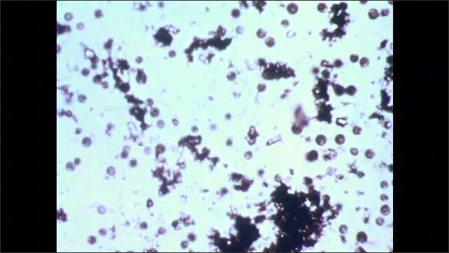1960s: Microscopic protozoa swim on microscope slide. Reproducing ...