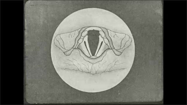 1930s: Animation of airway opening and closing. Animation of lungs ...
