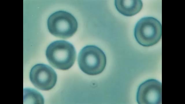1970s: Red blood cells float in plasma. Electron microscope photo of ...