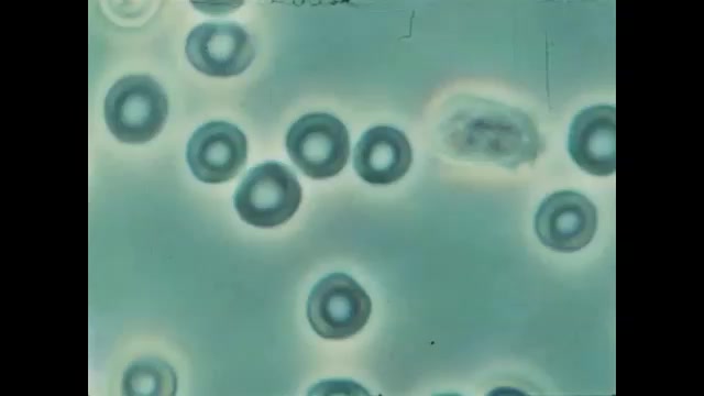 1970s: Red blood cells float around a white blood cell. White blood ...