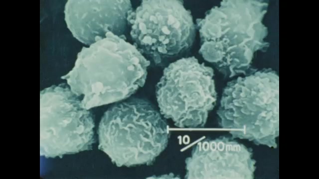 1970s: Electron microscope photo of white blood cells with a scale 10 ...