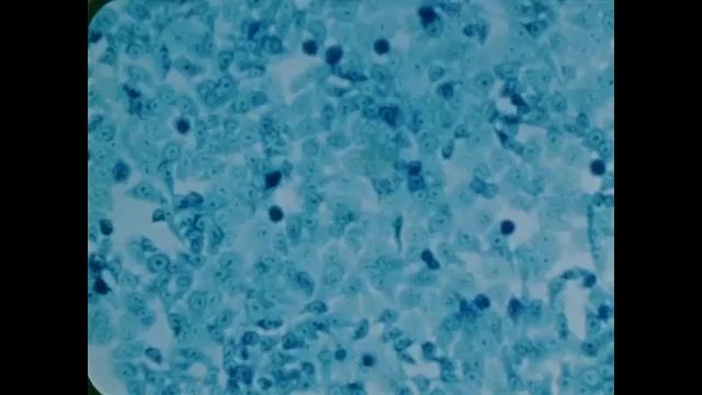 1970s: Microscopic images of germs, cells. Arrows point to cells, germs ...