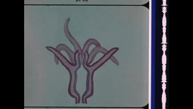 1990s: Diagram drawing of a sea anemone. Diagram drawing of cnidocytes ...