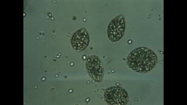 1950s: Bacteria cells and particles moving rapidly under microscope ...