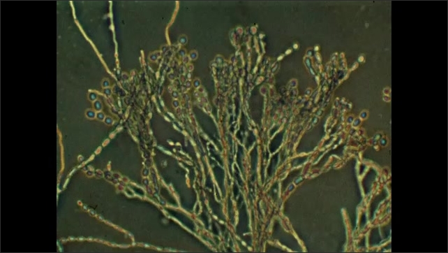 1960s: Microscopic view of mold. – Archival Footage