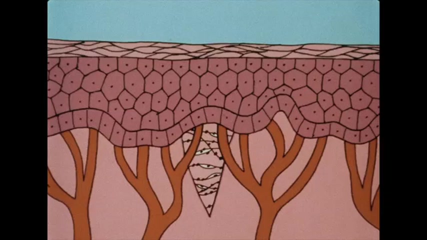 1990s: Animation – illustration of the dermis post-wound healing ...