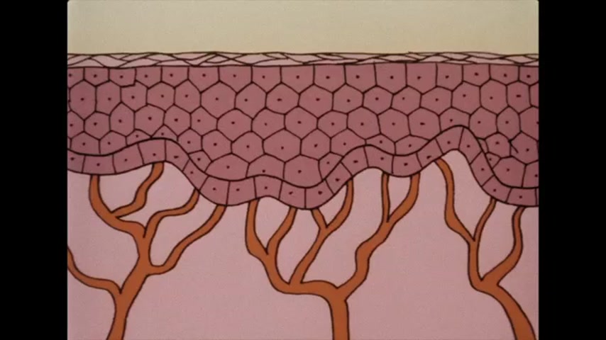 1990s: Animation – microscopic illustration of skin creating a bruise ...