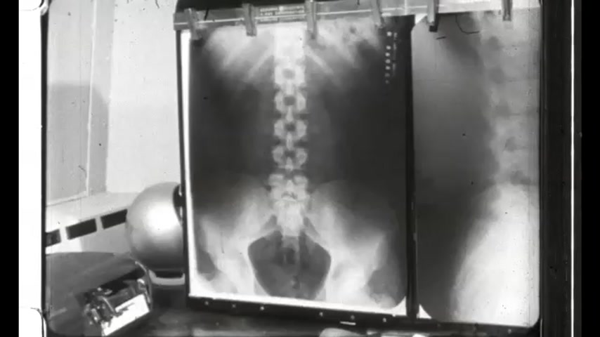 1960s: Parts of the x-ray pointed out. Nurse preparing patient for x ...