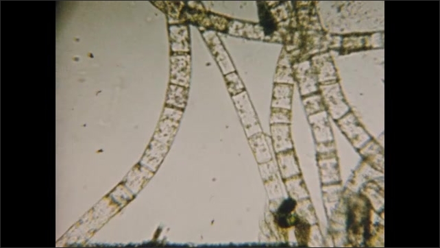 1950s: Magnified cells. Microscopic view of algae cells. – Archival Footage