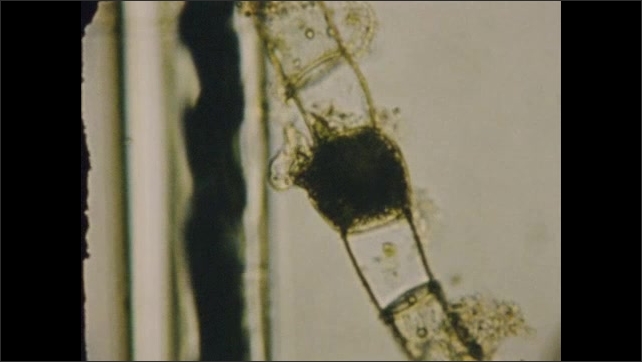 1950s: Microscopic view of egg cells on algae cell chain. New cell ...