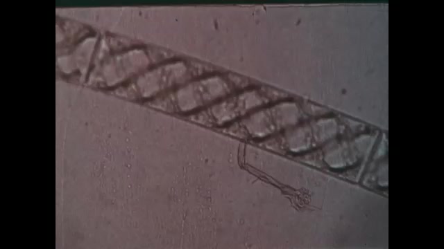 1970s: Microscope view of a spirogyra cell. Focus on the nucleus and ...
