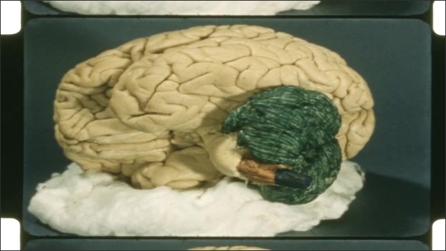 1950s: Model replica of brain. Model replica of brain with different ...