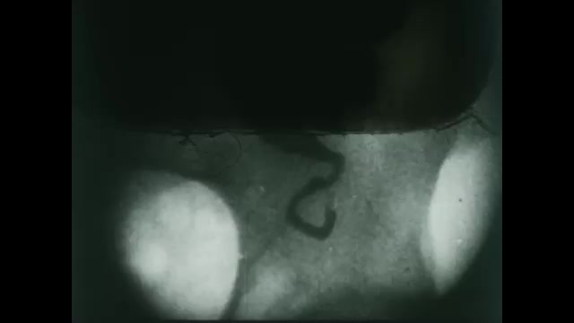 1950s: X-ray view of organs functioning. – Archival Footage