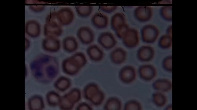 1950s: Microscopic close-up of deep red and blue stained cells ...