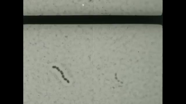 1950s: Microphotography of a segmented bacterium. Side by side ...