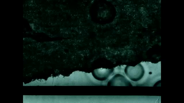 1950s: Microphotography of red and white blood cells. A white blood ...