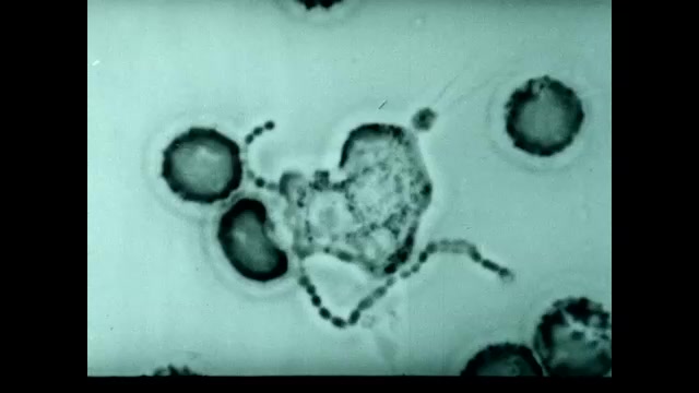 1950s: Microphotography of a white blood cell engulfing a segmented ...