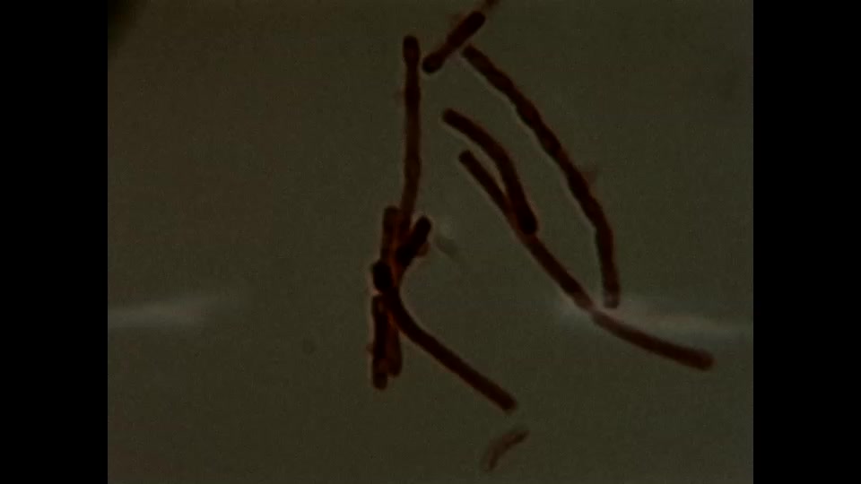 1960s: Long organisms under the microscope. – Archival Footage