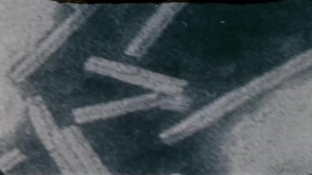 1950s: Microscopic view of long bacteria cells. – Archival Footage
