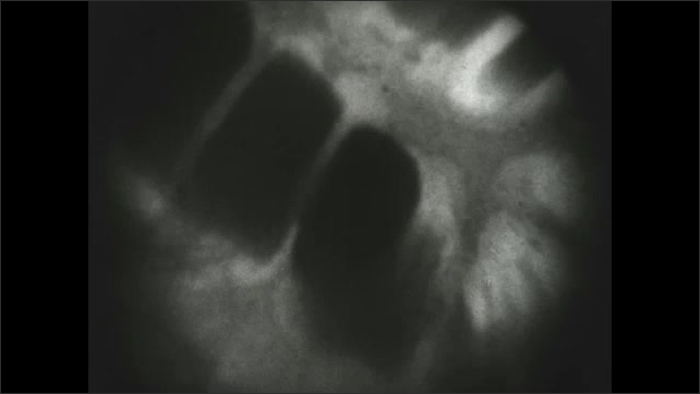 1960s: X-ray of material moving through the gastrointestinal system. X ...