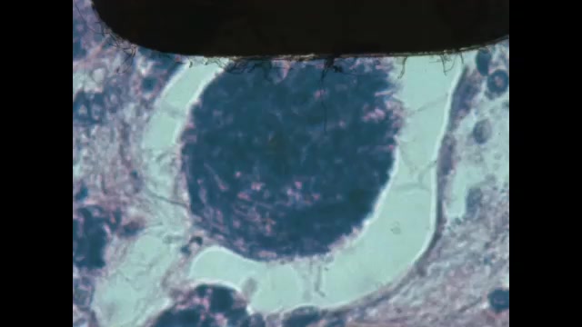 1960s: stained slice through cell. Parasites in water. Planarian ...