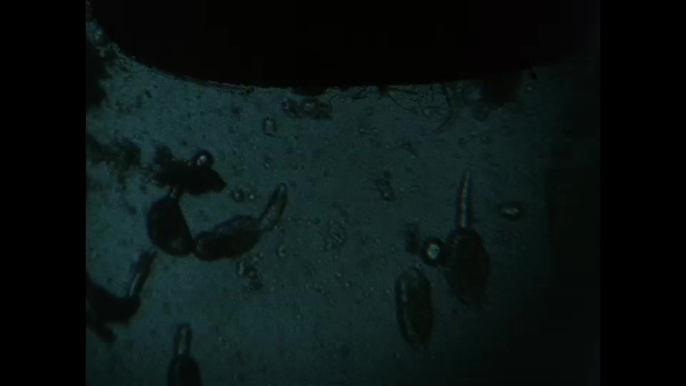 1960s: Flatworm larvae wriggle and move on a microscope slide ...