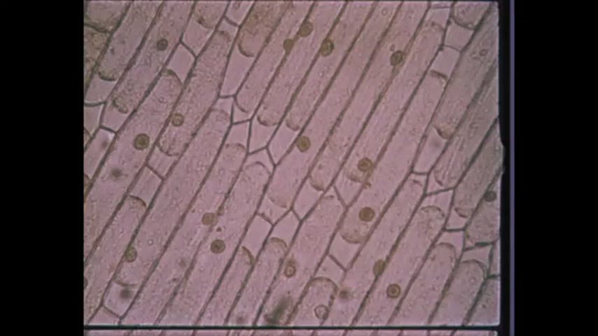1940s: Cells under light microscope. Nuclei stained. – Archival Footage