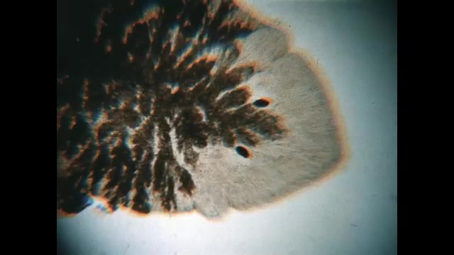 1970s: Magnified head of worm. Drawing of flatworm. Worms in dish ...