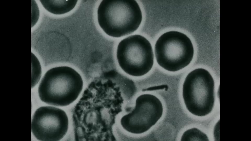 1960s: Bacteria surrounded by cells, being broken down by them ...