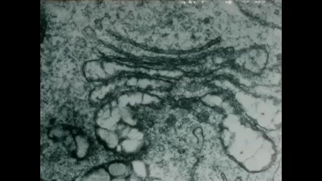 1980s: Golgi apparatus appears in electron microscope image. Amoeba ...