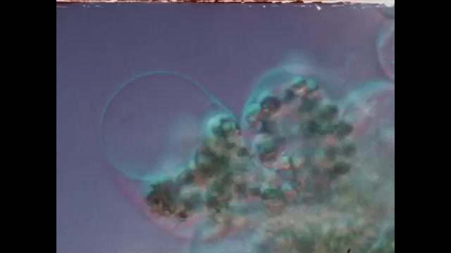 1980s: T-cells. Diagram of receptor proteins on the surface of a cell ...