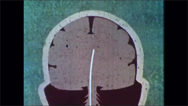 1960s: Animated hand points to skin. Flashing animated sparks. Animated ...