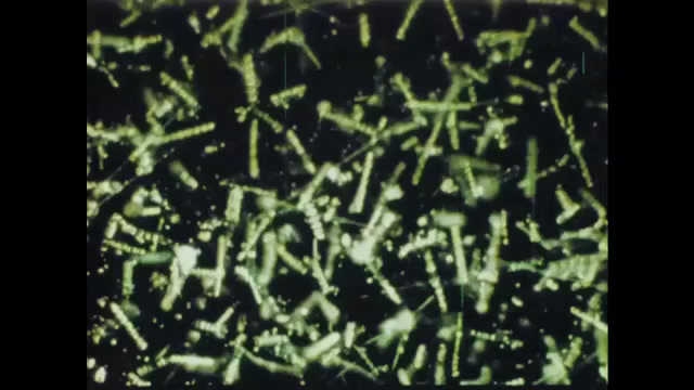 1970s: microscopic view of golden algae. Diatom cells with nucleus ...